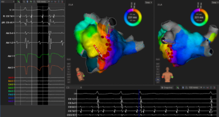 Electrofisiología - Crivelsa